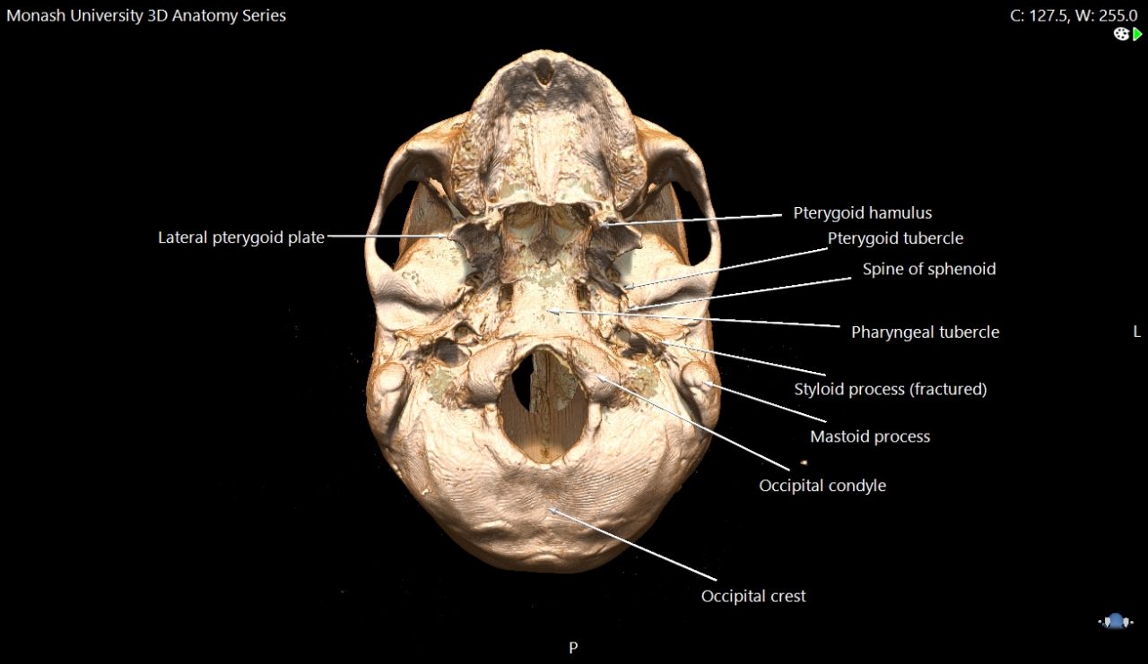 M005 Dural Skull – Portal de Educación – Guía de contenido